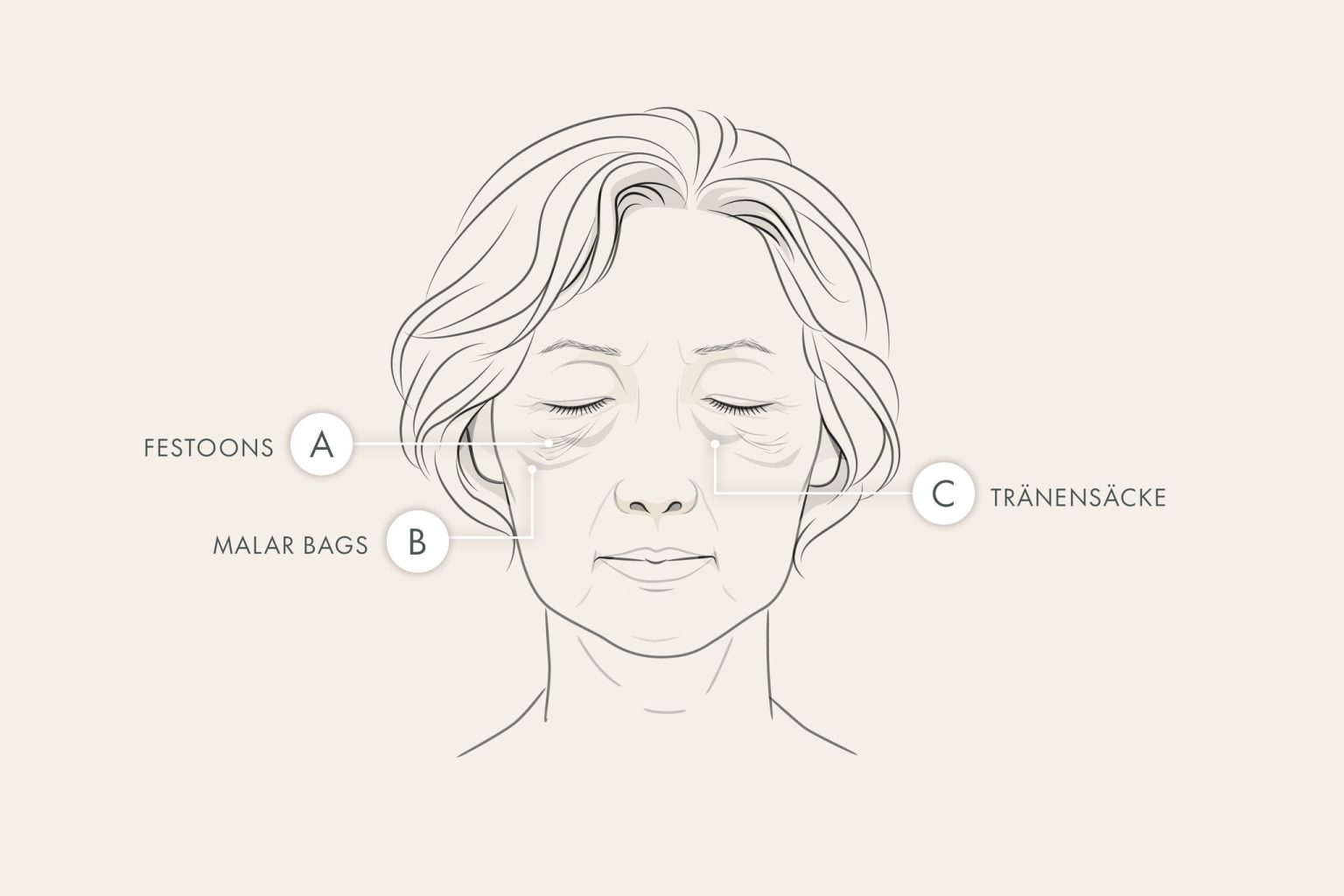 Malar Bags & Festoons: Effektive Lösungen & Expertenberatung