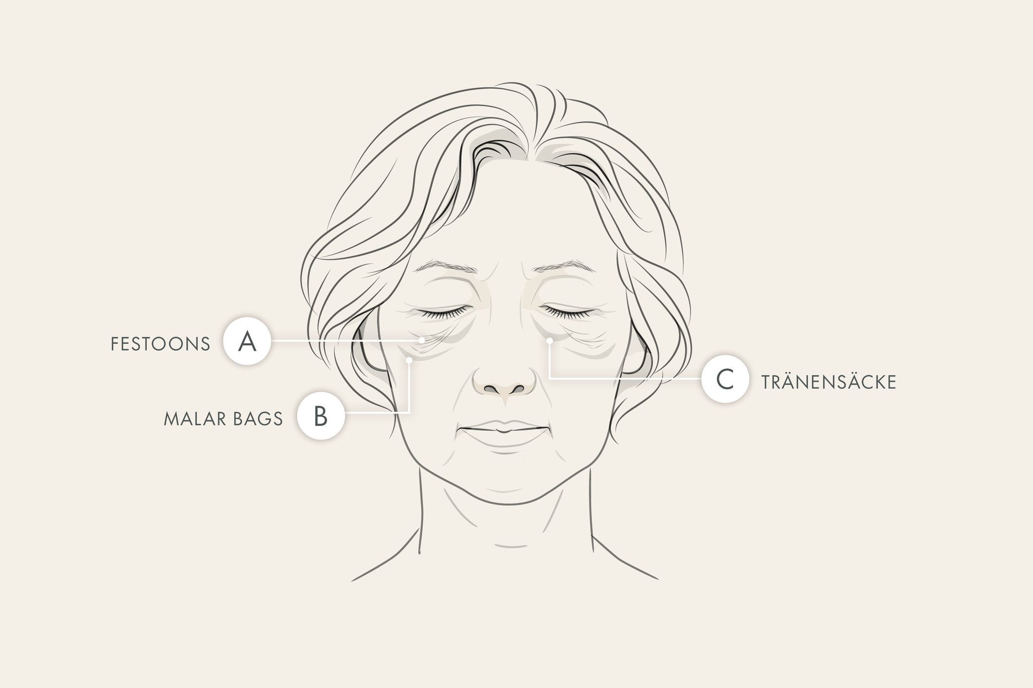 Malar Bags & Festoons: Effektive Lösungen & Expertenberatung