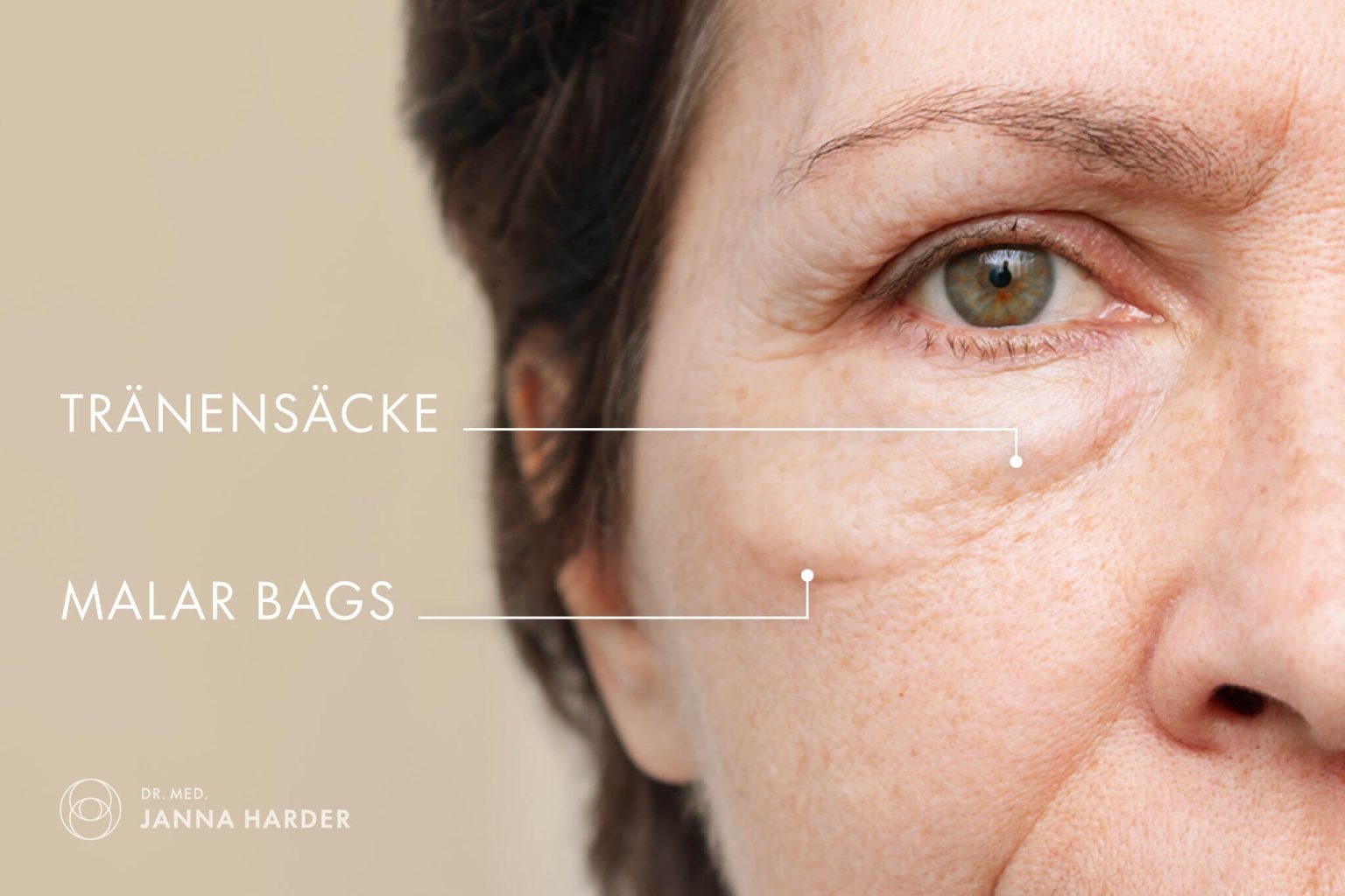 Malar Bags & Festoons: Effektive Lösungen & Expertenberatung